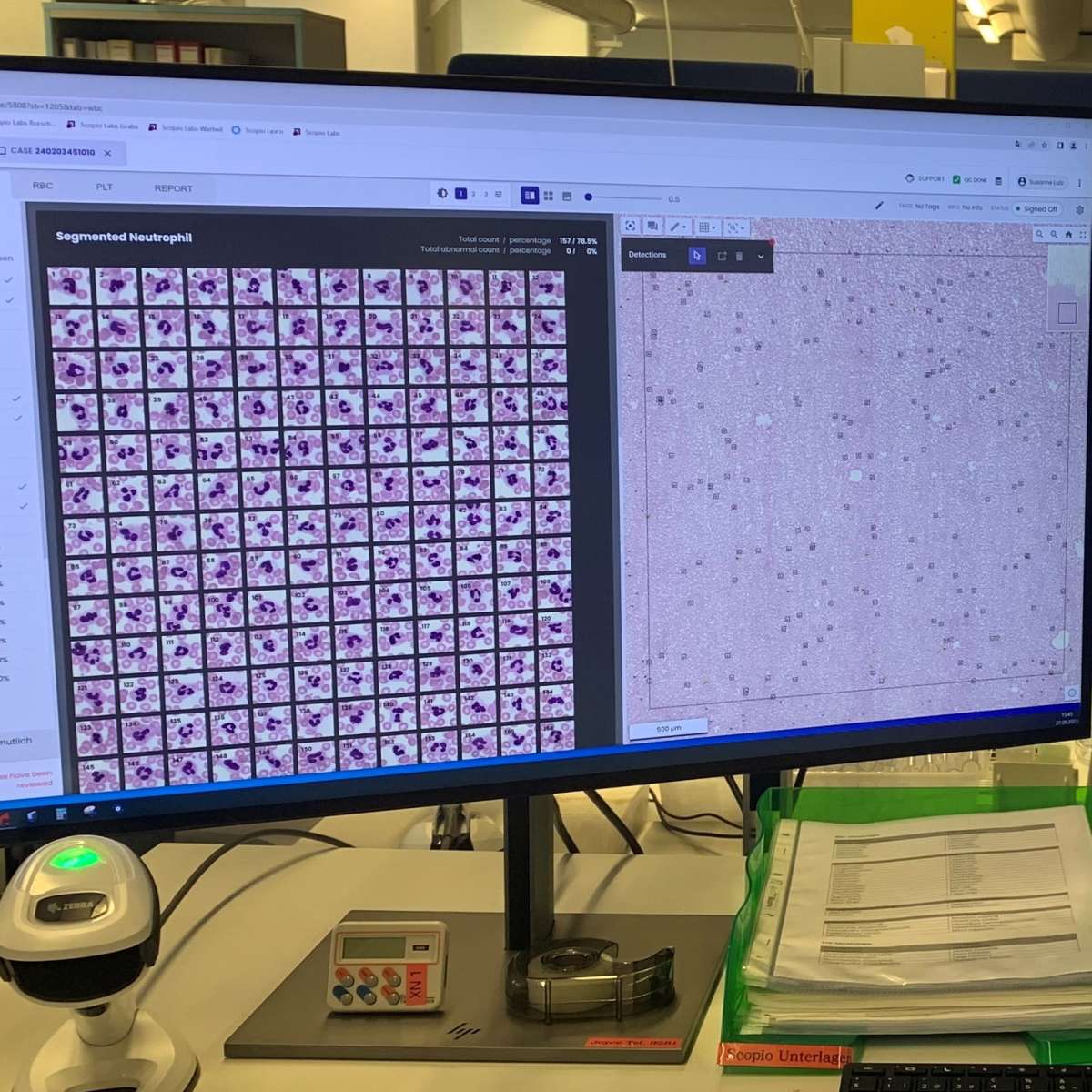 Digital, AI-supported full-field blood count diagnostics at the Center ...